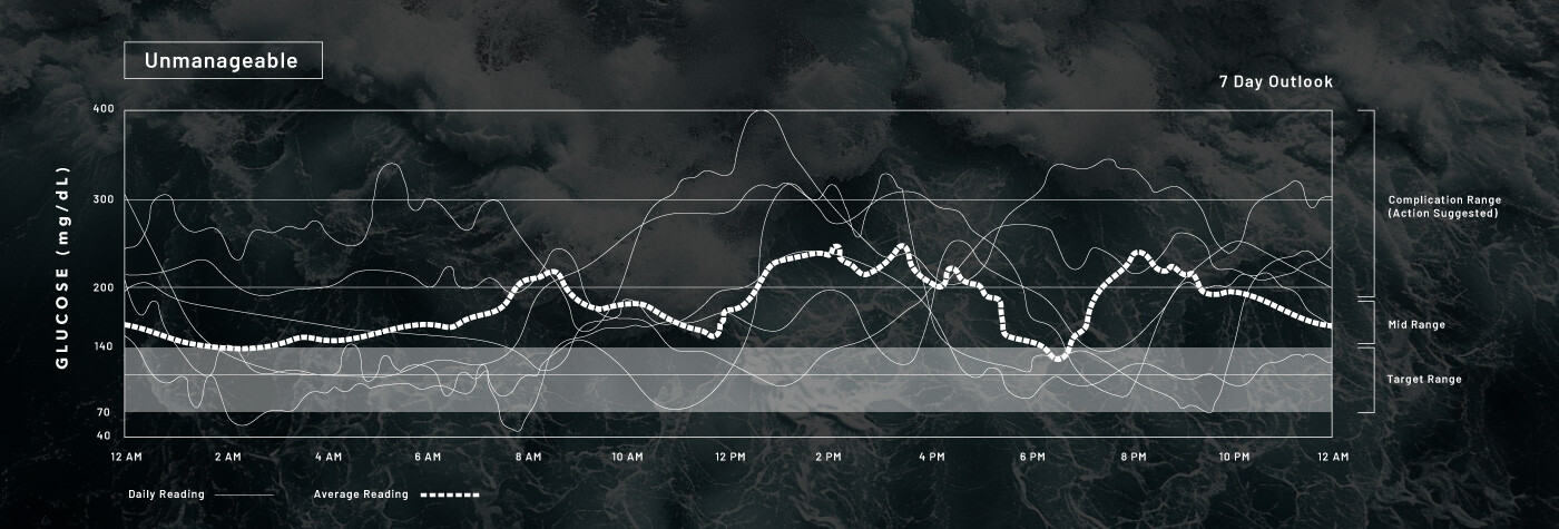 Seraccess® SENSE - Artificial Pancreas Device System (APDS)