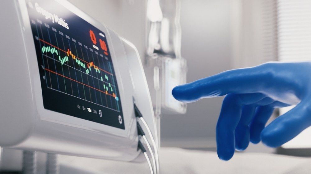 GETTING A GRIP ON OXYGEN TRANSFER IN BIOREACTORS: AUTOMATED kLa ...